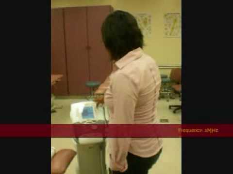 Ultrasound (TFCC) - YouTube