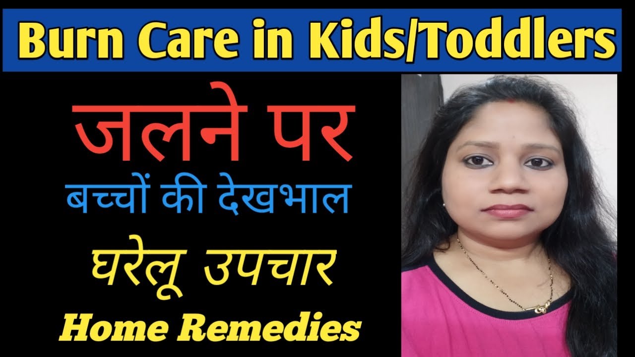Burn Care in Kids/Toddlers|| घरेलू उपचार||Home Remedies - YouTube