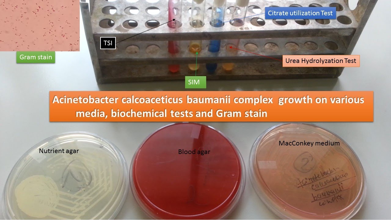 Acinetobacter Calcoaceticus Gram Stain