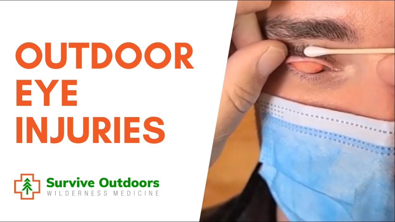What are Outdoor Eye Injuries? - Assessment and Treatment on the Trail ...