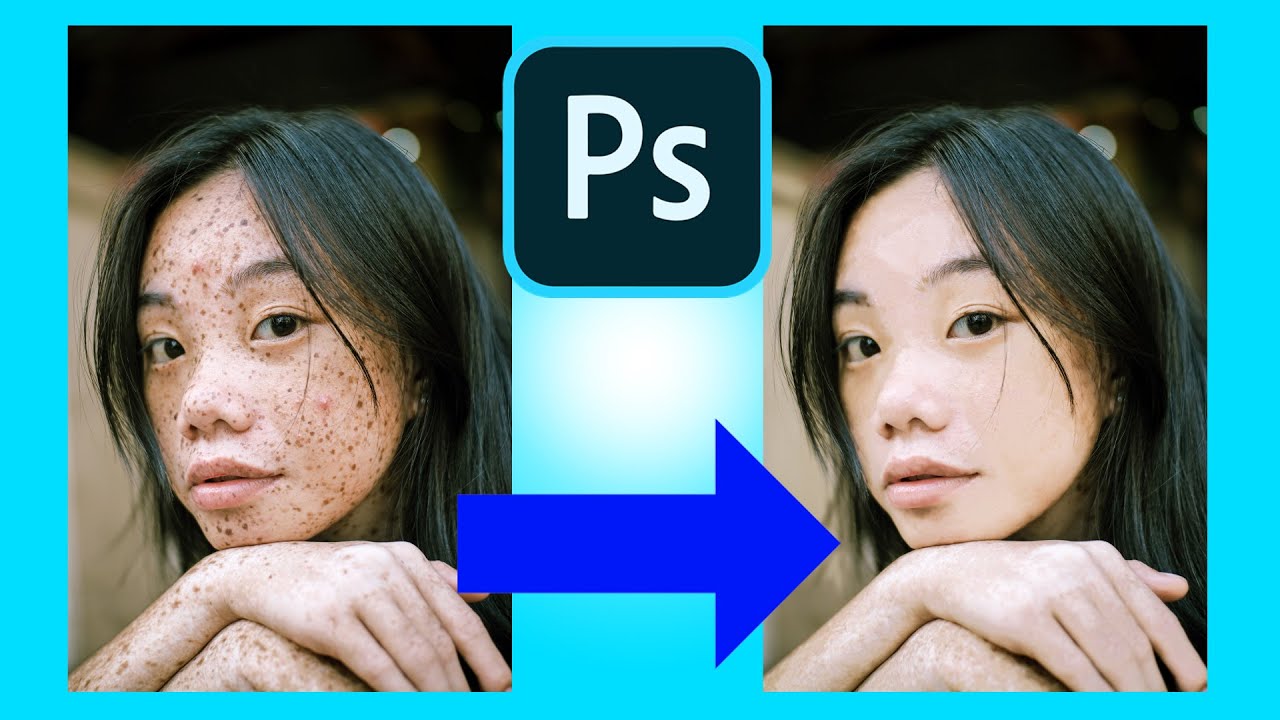 Face Clean in Photoshop | its Easy !! Smooth Skin and Remove Blemishes ...