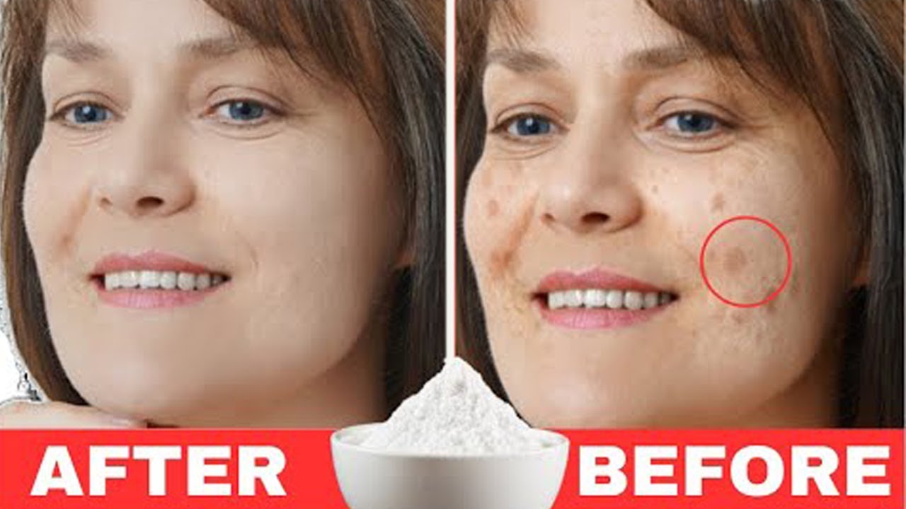 BAKING SODA Removes AGE SPOTS forever! Just do THIS... - YouTube
