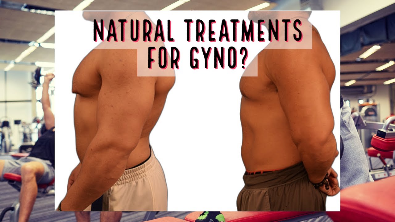 Natural Remedies To Fix Gyno Gynecomastia Treatment Options Youtube