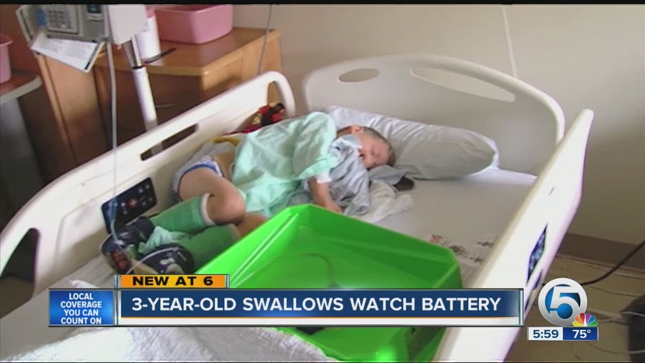 3 year old Swallows Watch Battery YouTube 3-year-old-swallows-watch-battery-youtube