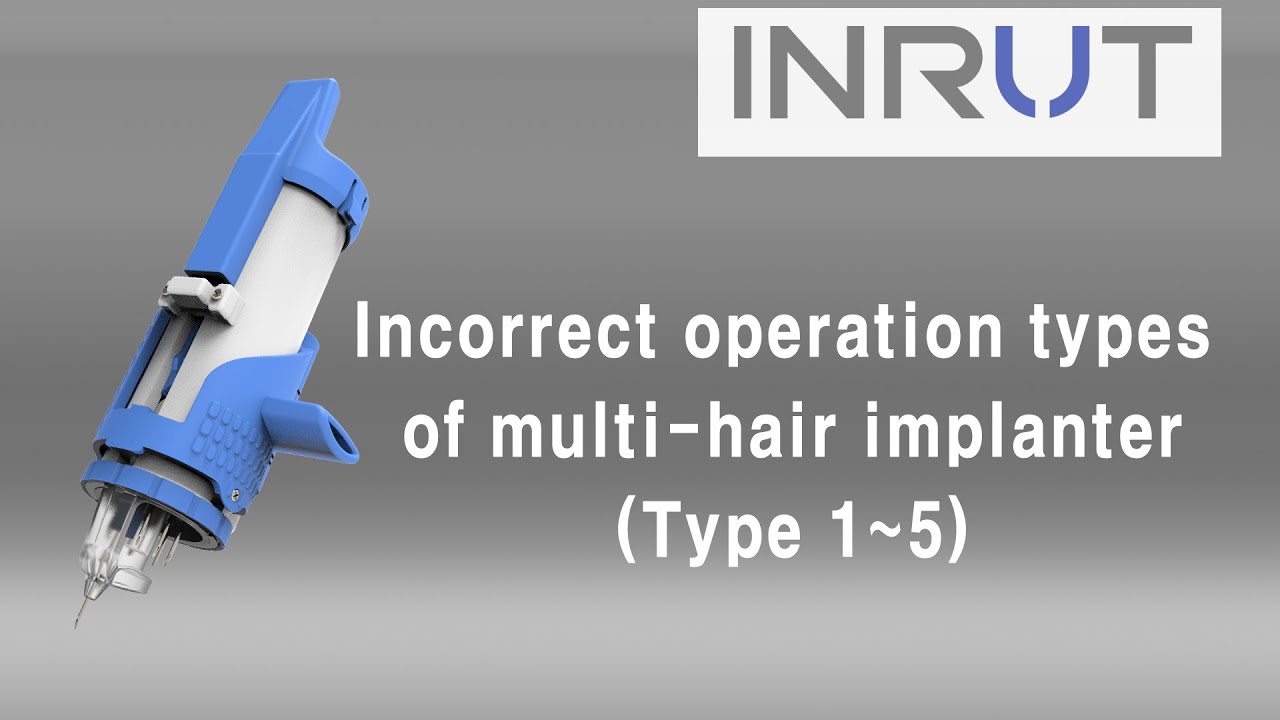Incorrect operation types of INRUT multi hair implanter(Voice) - YouTube