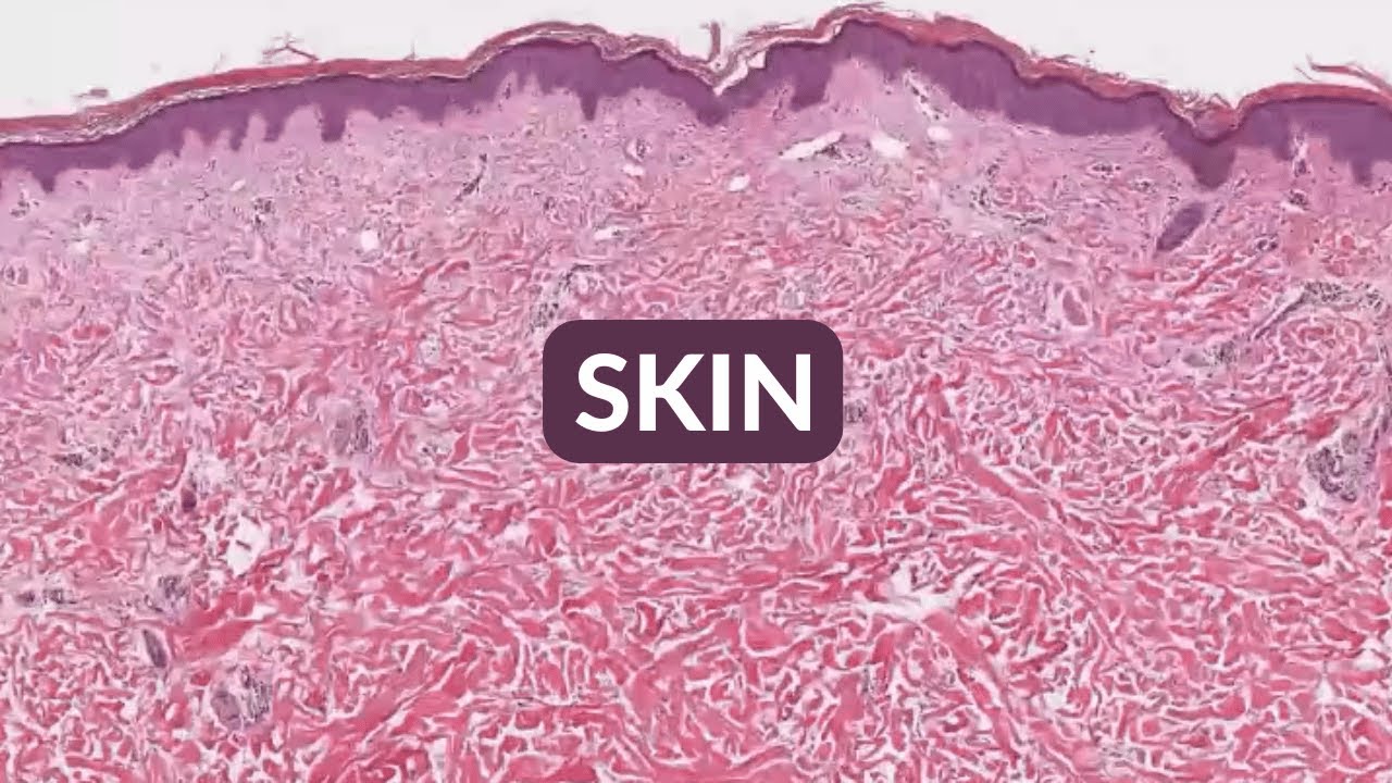 Histology Made Easy: Skin - YouTube