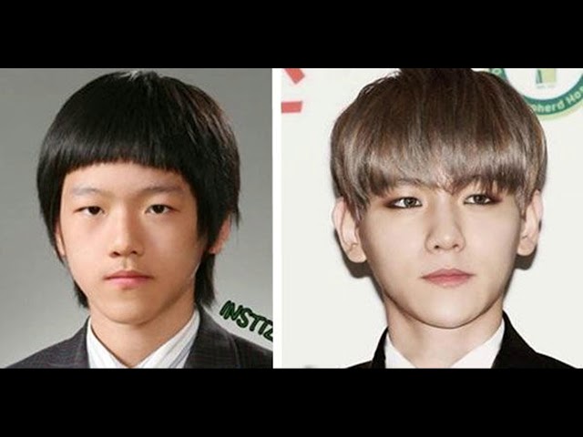 Exo Before And After Plastic Surgery