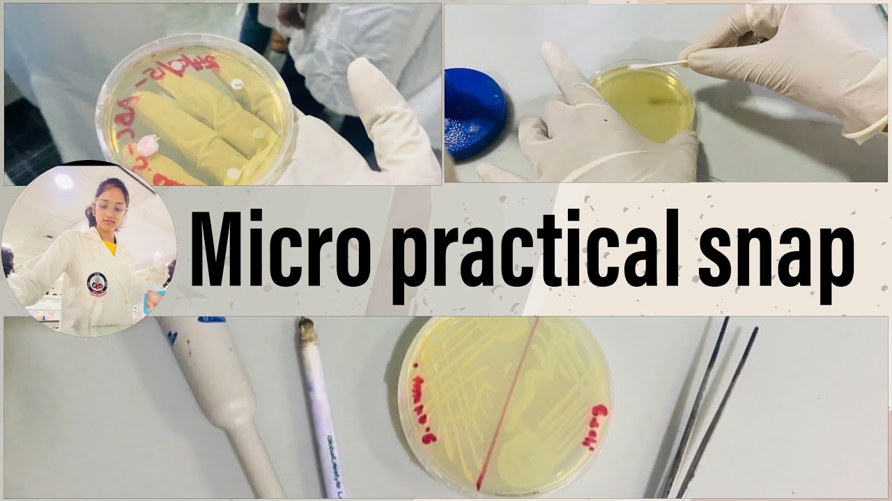Micro Practical Snap | Evaluation of Antimicrobial Activity 🦠🧪 - YouTube