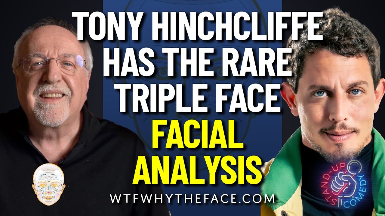 Comedian Tony Hinchcliffe's Face Tells His Story: Facial Analysis ...