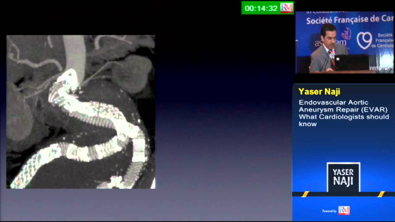Endovascular Aortic Aneurysm Repair (EVAR) What Cardiologists should ...