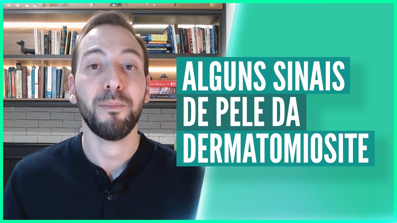 Alguns sinais de pele da dermatomiosite - YouTube