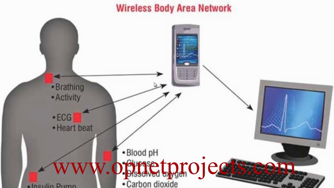 OPNET WIRELESS BODY AREA NETWORK SIMULATIONS WBAN - YouTube
