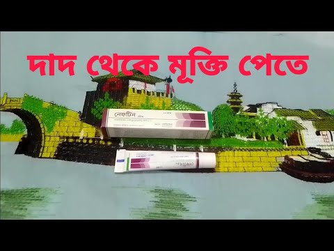 Naftifin cream ki, kon rog hole skin/Toke deben - YouTube