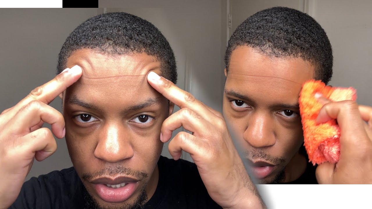 How to Remove Durag Line from Your Forehead FAST - YouTube