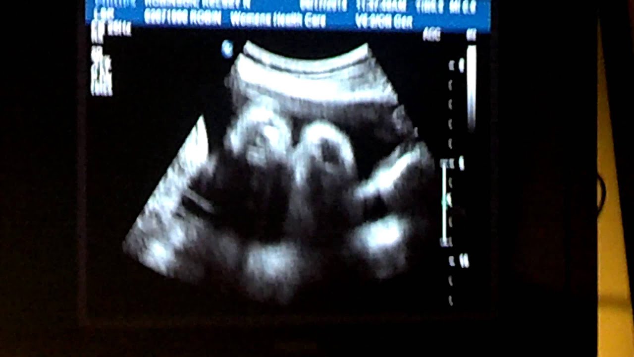 Baby Caiden's 40 week ultrasound - YouTube