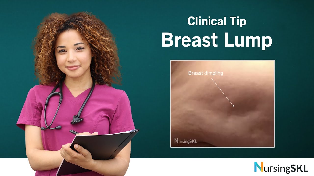 Breast Cancer Symptoms Dimpling Pictures