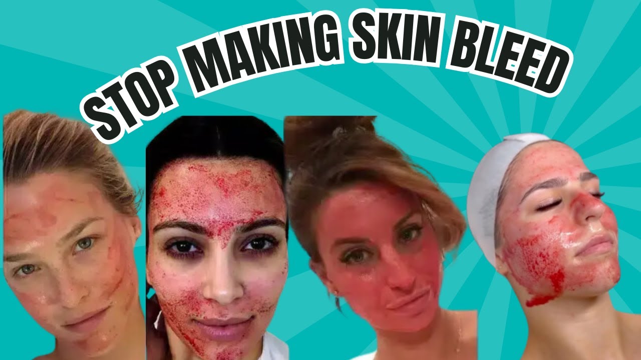 3 reasons why you should not make skin bleed when microneedling - YouTube