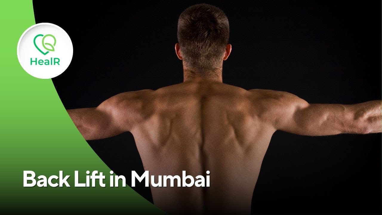 Back Lift Surgery in Mumbai: Costs, Recovery, and What to Expect ...