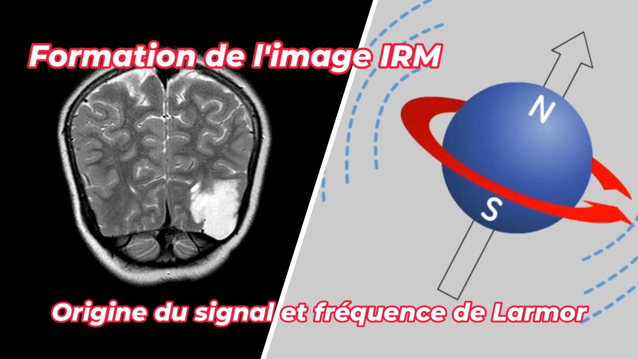 IRM: Origine du signal et fréquence de Larmor | Précession des protons ...