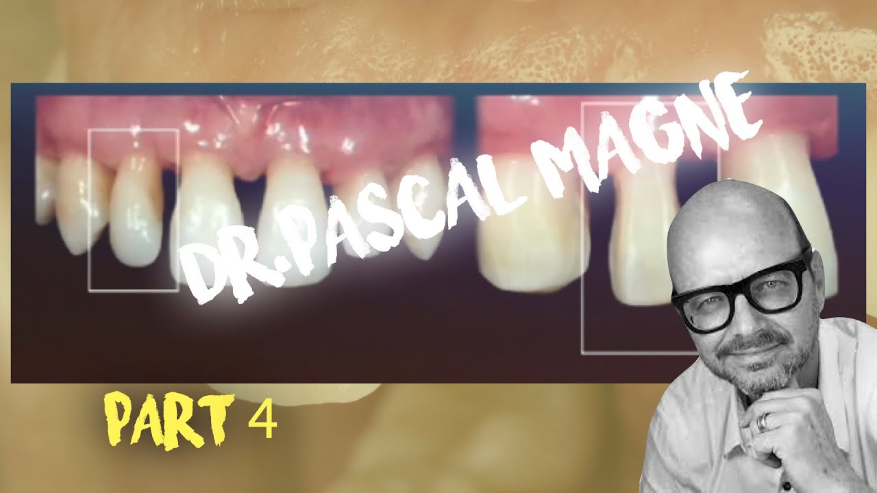 Pascal Magne Part #4 - YouTube
