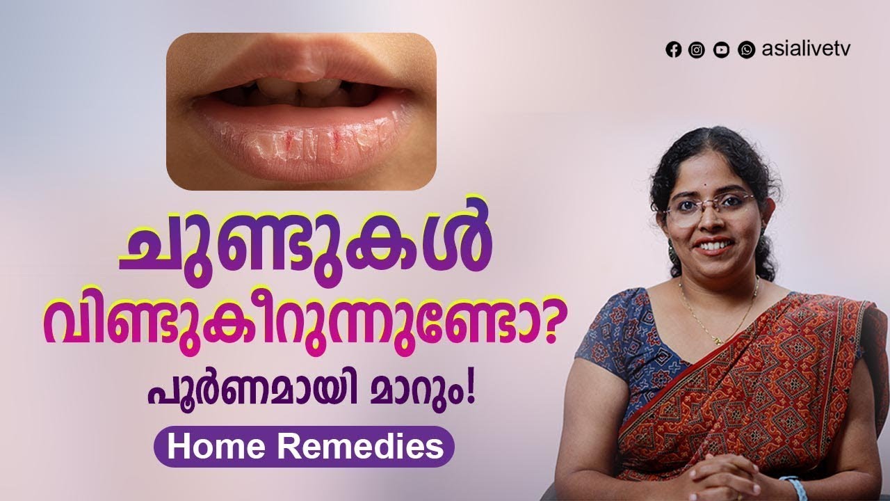 Cracked Lips? Causes & Complete Healing Tips - YouTube