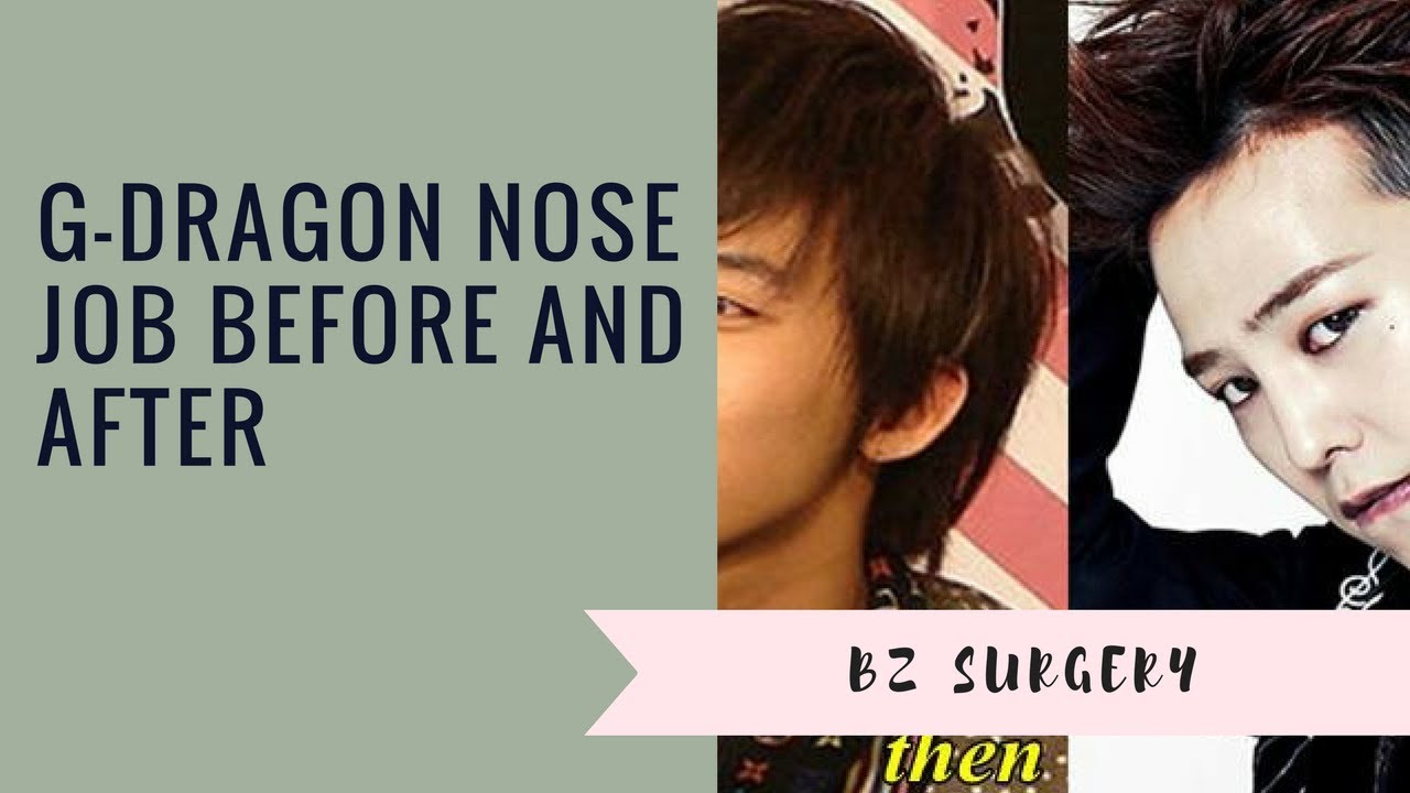 G Dragon Nose Job Before and After - YouTube