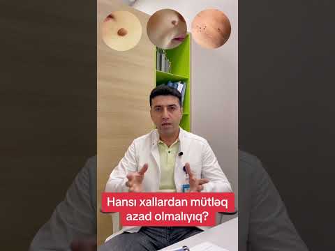 Hansı xallardan mütləq azad olmalıyıq? #ətxal #xallarin goturulmesi #dermatoloq