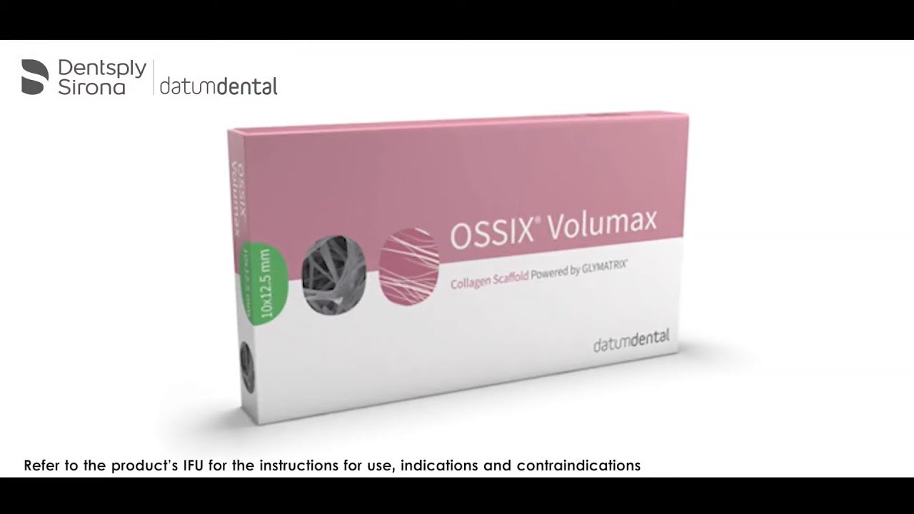 Lateral Bone Augmentation for increased volume demonstration with OSSIX ...