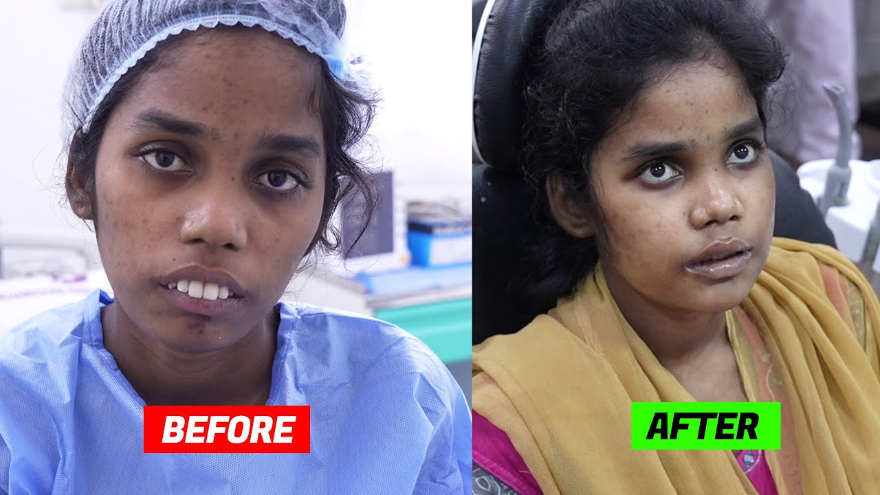 The Most Stunning Plastic Surgery Transformation - YouTube