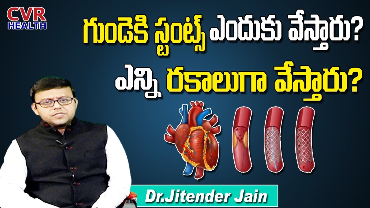 Heart Stent Implantation | Types And Proceduce | Cardiologist Dr ...