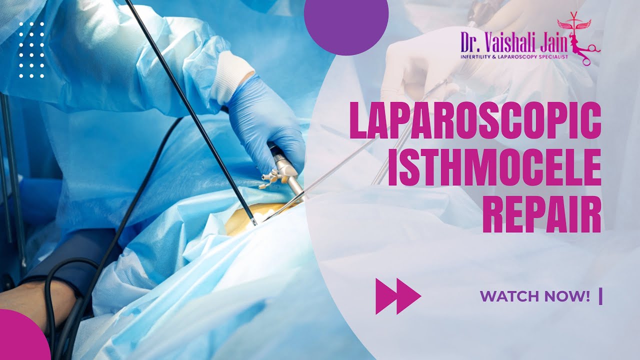 Laparoscopic Isthmocele Repair | Uterine Niche Closure demonstrated by ...