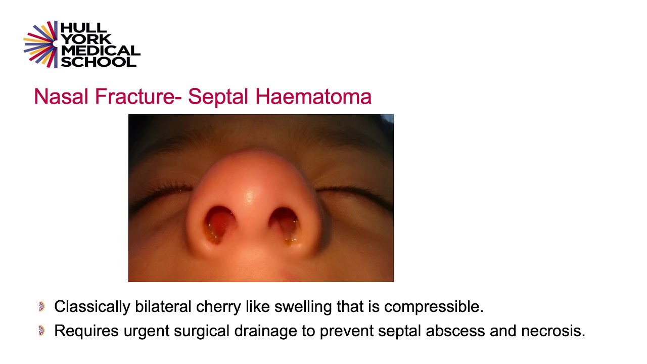 ENT Emergencies - YouTube