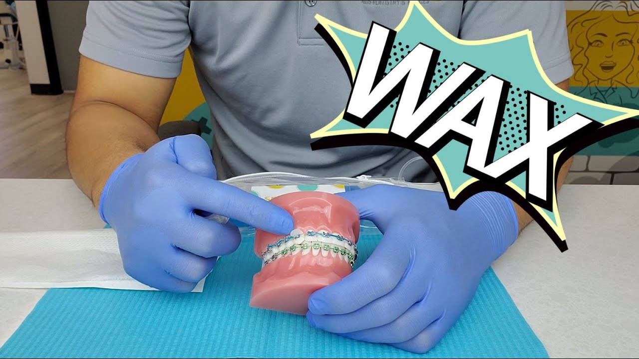 Wax for Braces! Explained by Dr. Martinez of Smile Squad LV - YouTube
