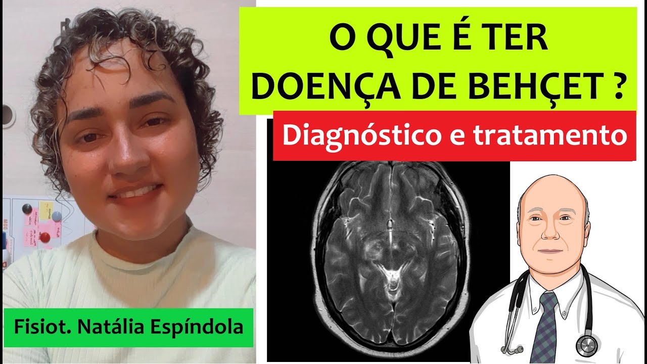 As dificuldades com a doença de Behçet: primeiros sintomas, diagnóstico ...