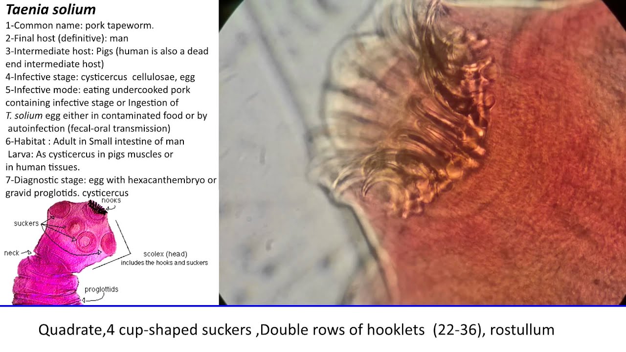 Taenia Solium Scolex