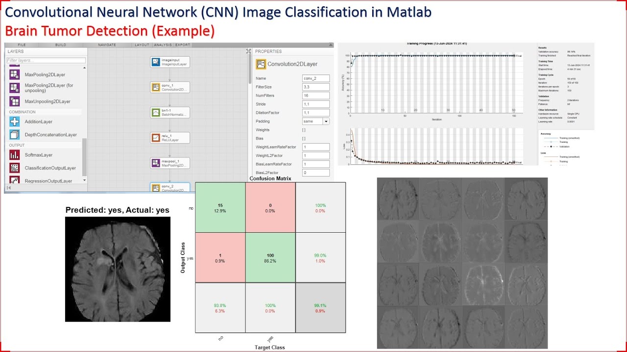 Convolutional Neural Network (CNN) Brain Tumor Detection (Matlab), الشيكات العصبية العميقة - YouTube