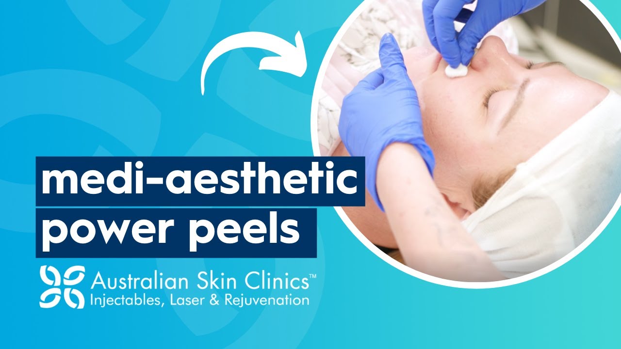 Medi Aesthetic Power Peels Explained | Australian Skin Clinics - YouTube