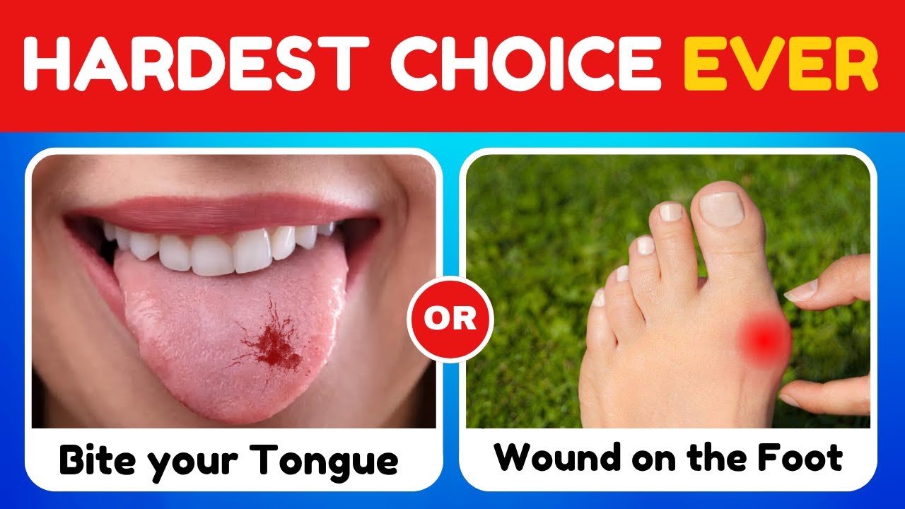 Would You Rather...? Hardest Choice Ever! 😱👀⚠️ Extreme Edition | Parrot ...