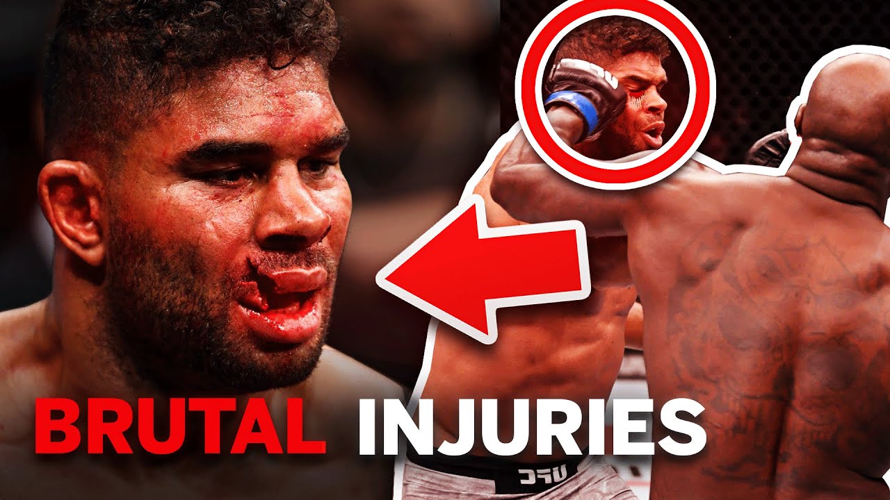 8 UFC Battles That Ended With Brutal Injuries | Mixed Martial Arts ...