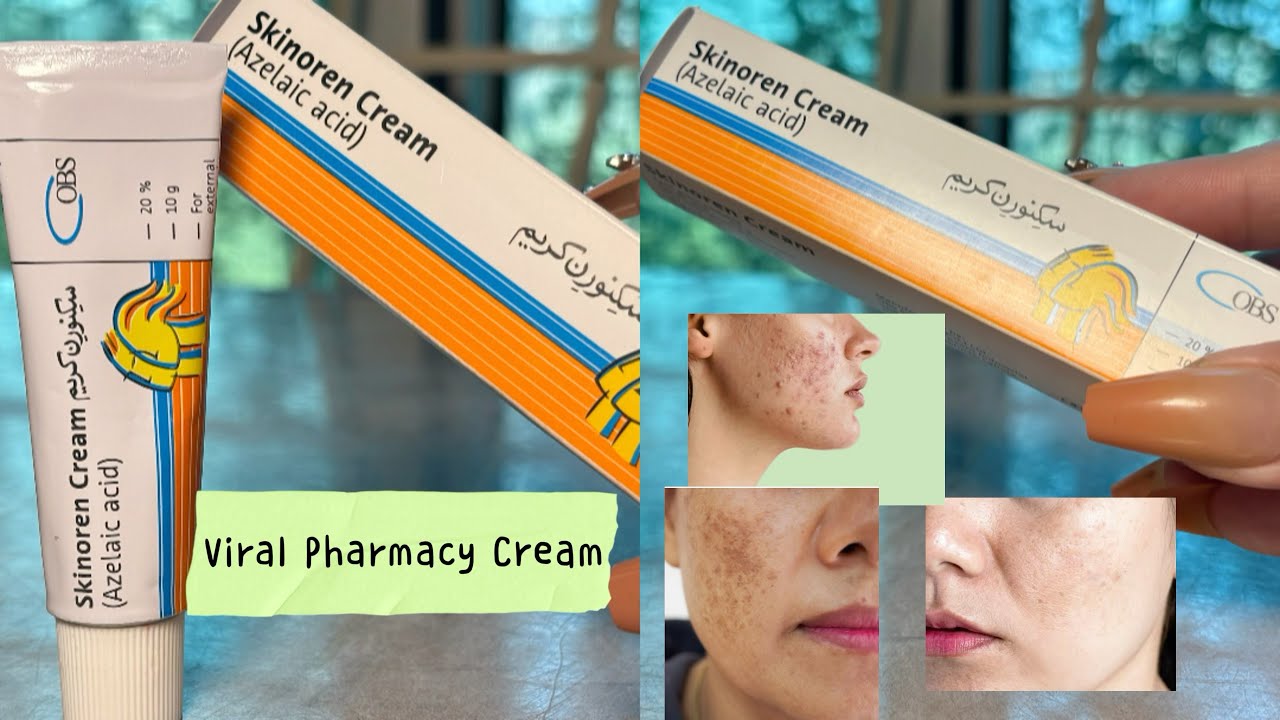 My Experience With Skinoren Cream || Best Solution For Acne ,Scars ...
