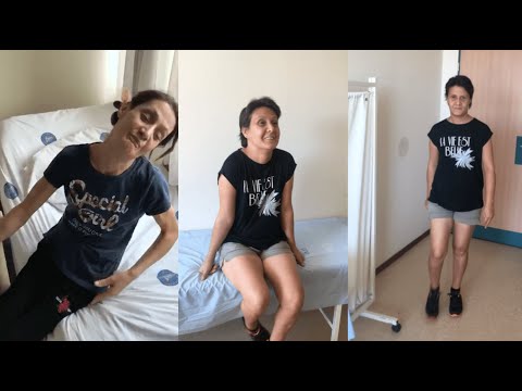 Prof. Dr. Tanju Uçar - Travma Sonrası Distoni Hastası - Öncesi & Sonrası
