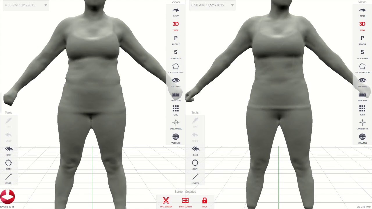 Styku 3D Body Scan Overview YouTube