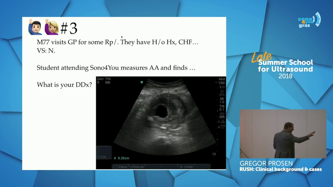 RUSH: Clinical background & cases - Gregor Prosen - YouTube