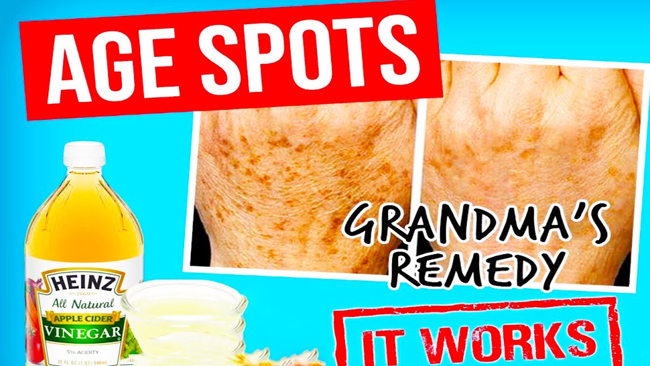 How to REMOVE AGE SPOTS with just one INGRIDIENT - YouTube