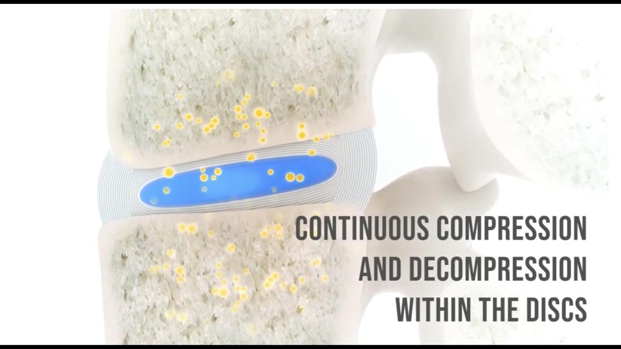 Protec Spine - Floating Manipulative Spinal Decompression. - YouTube