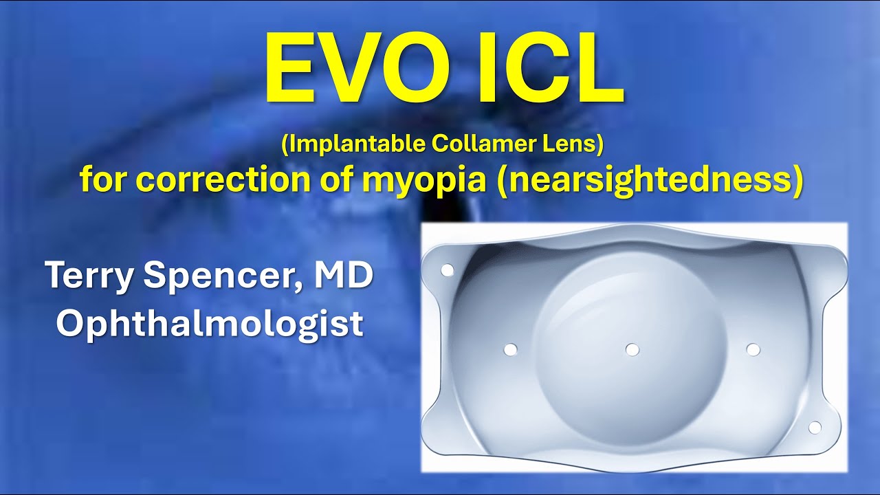 EVO ICL for correction of myopia - YouTube