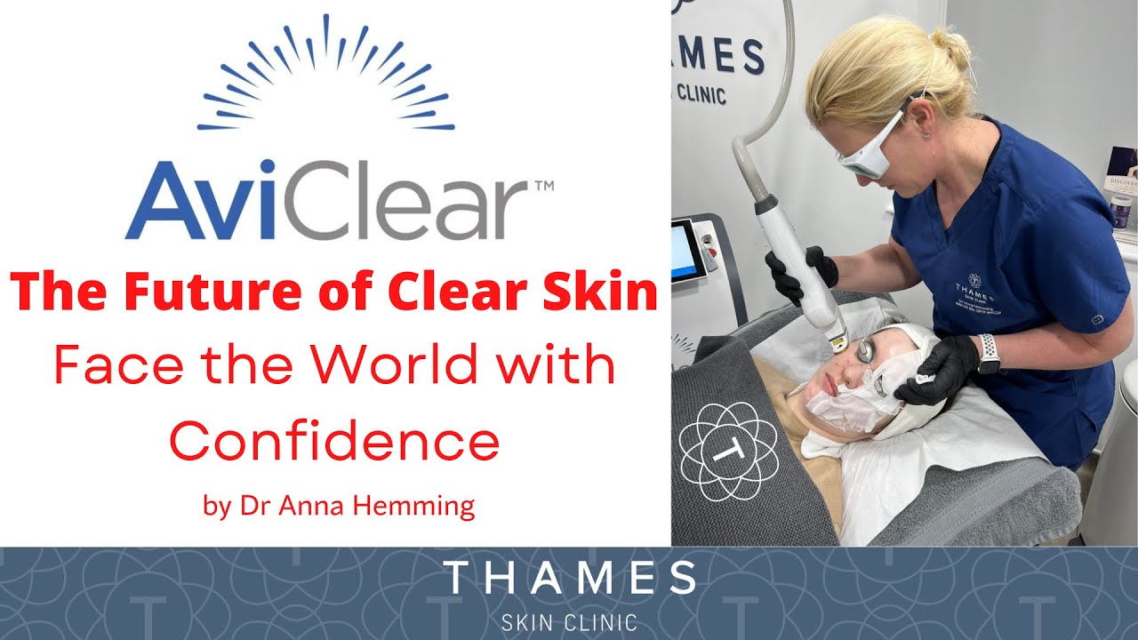 AviClear - The ground-breaking new acne laser treatment has arrived at ...