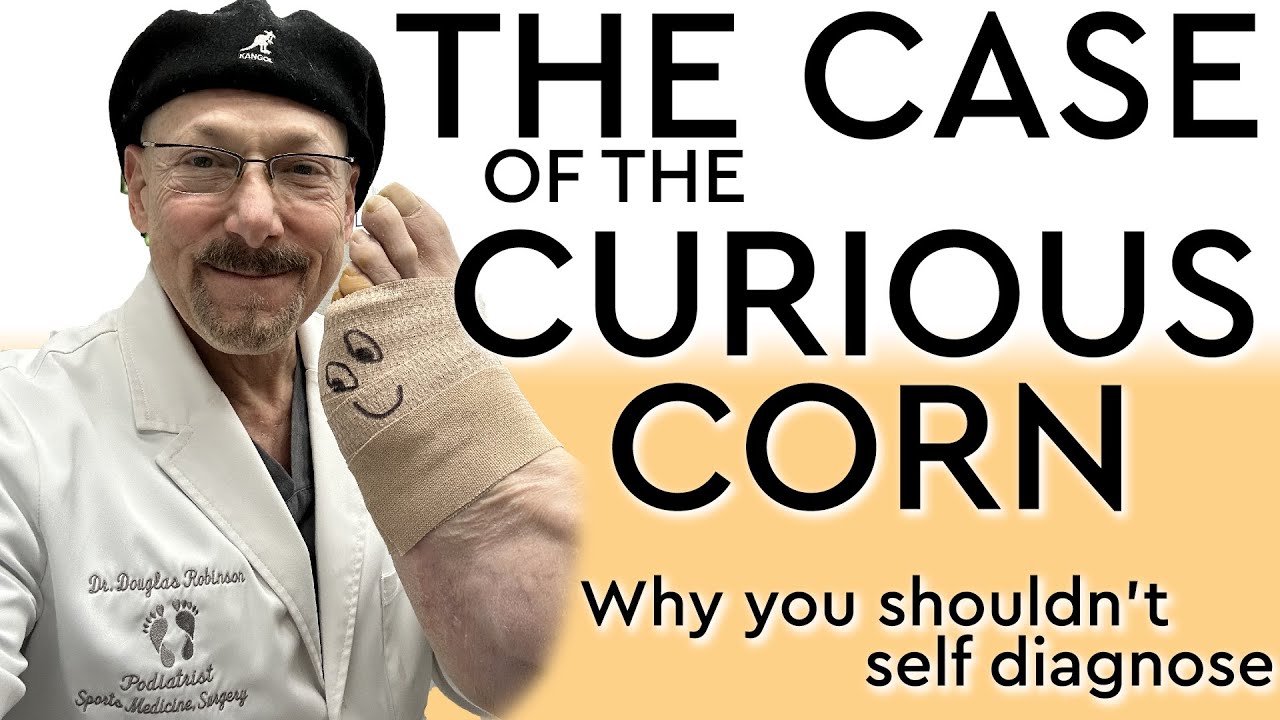 The Case of the Curious Corn // Why You Shouldn't Self-Diagnose - YouTube