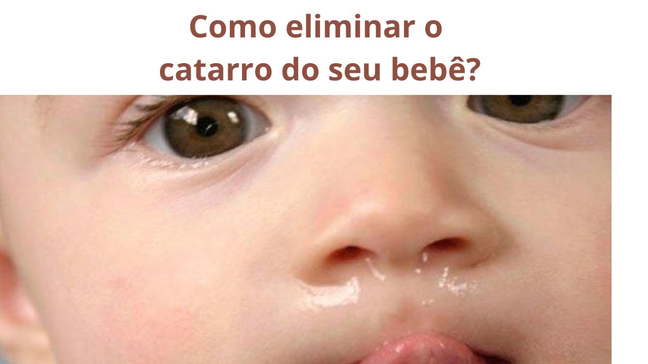 Como eliminar o catarro do seu bebê? - YouTube