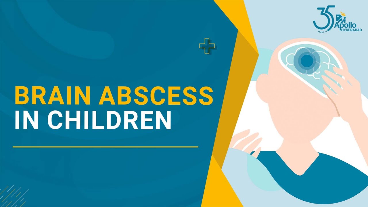 Brain Abscess in Children? | Dr. Tarang Vora | Neurosurgeon | Apollo ...
